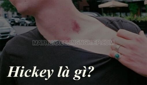 Hickey là gì? Cách tạo hickey kiss ấn tượng, an toàn sức khoẻ